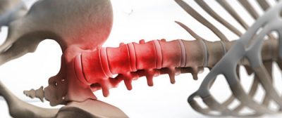 4 Causes of lower back pain - Low Back Pain Program